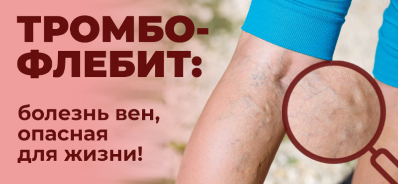Как сохранить здоровье вен и сосудов. Профилактика тромбоза